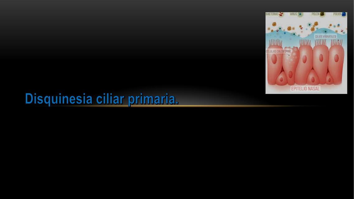Disquinesia ciliar primaria | Dr gomez | uDocz