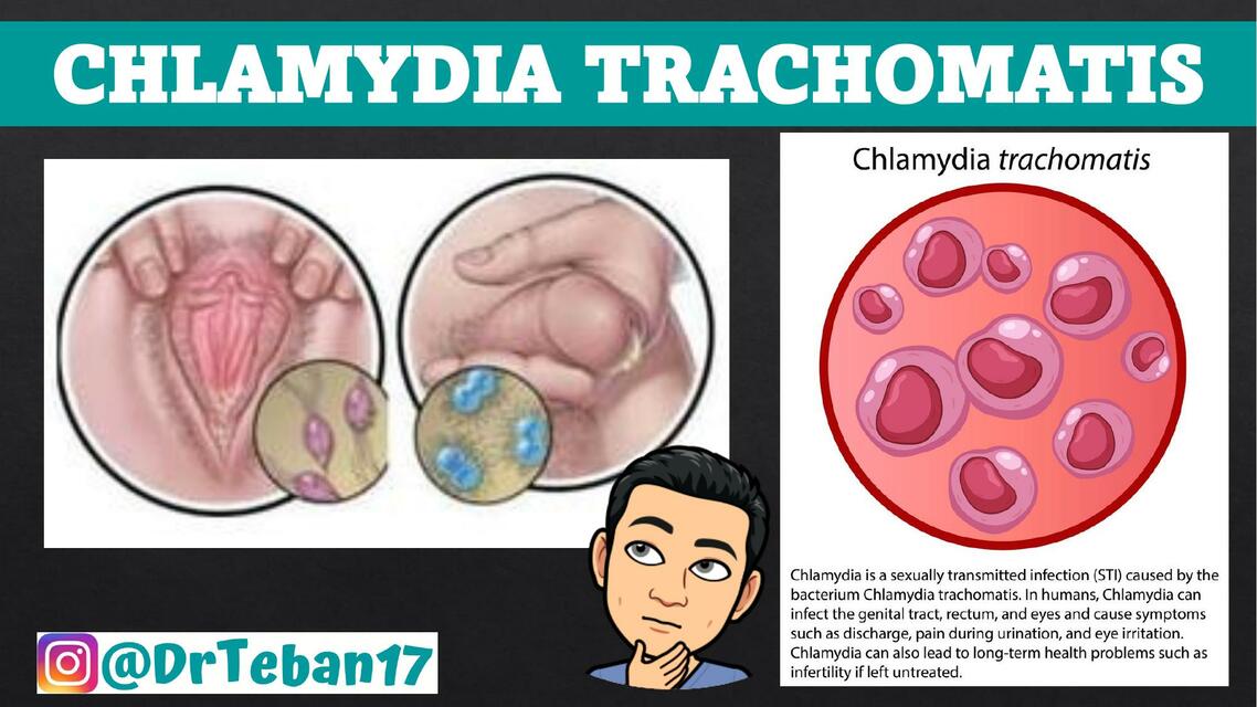 CHLAMYDIA TRACHOMATIS | DrTeban17 | uDocz