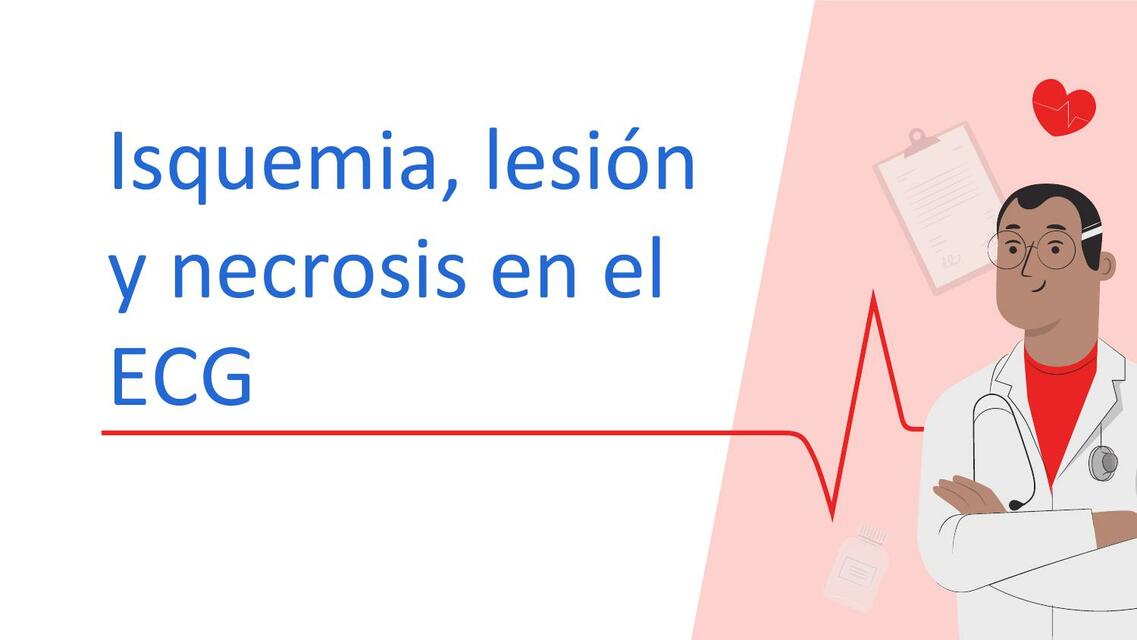 Isquemia, Lesión y Necrosis en el EKG - Cardiología | GuiasMed | uDocz