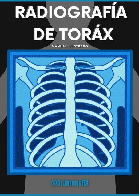 Radiografía de tórax | Jazz Ok | uDocz