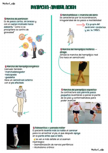 Tipos de Marcha | Medical Coffe | uDocz