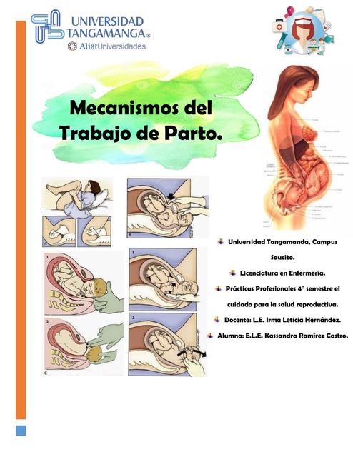 Mecanismo De Trabajo De Parto - wraptips Mecanismo De Trabajo De Parto - wraptips