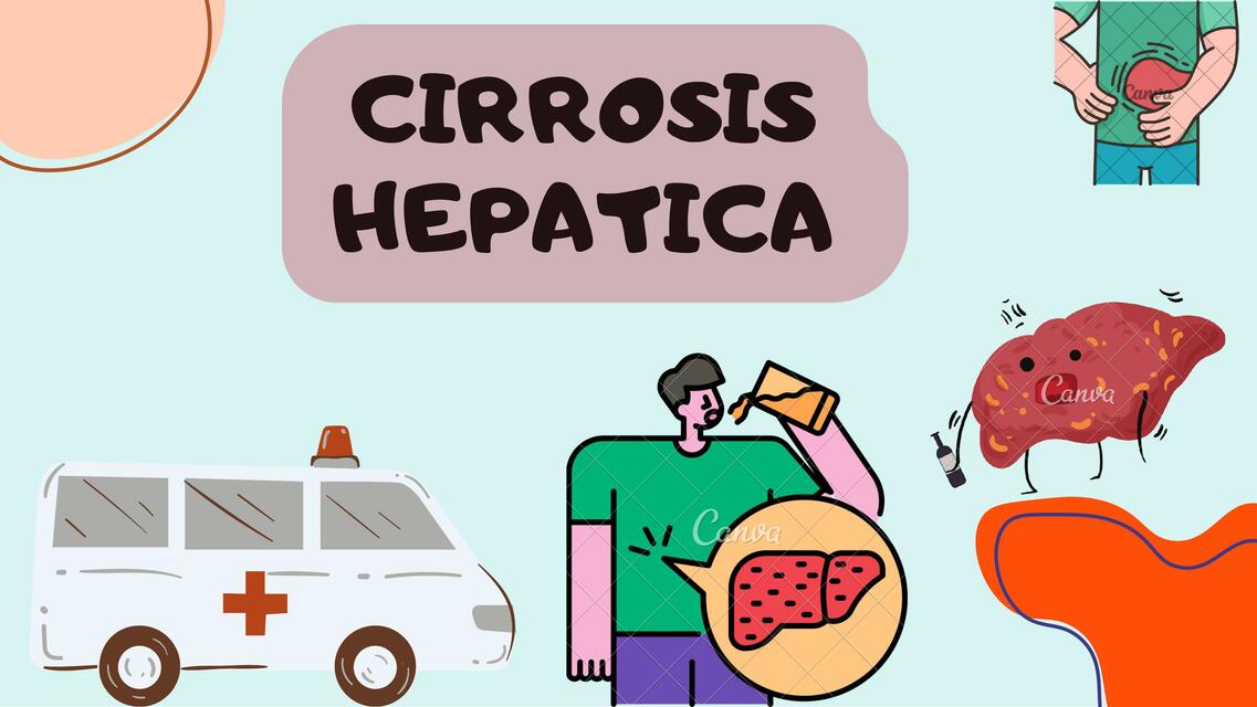 Cirrosis hepática | JANI-MC | uDocz