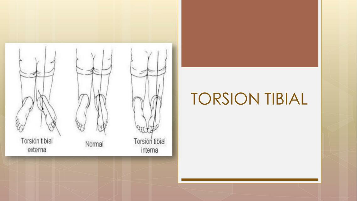 Torsión Tibial | Alezka | uDocz