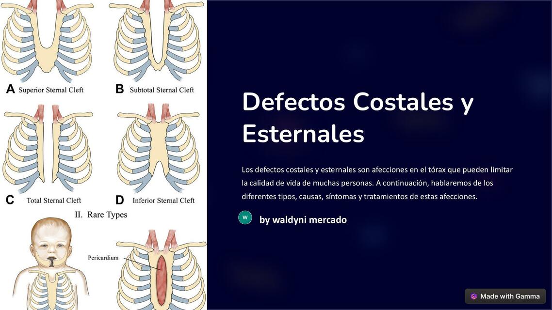 Defectos Costales y Esternales | Waldyni mercado | uDocz
