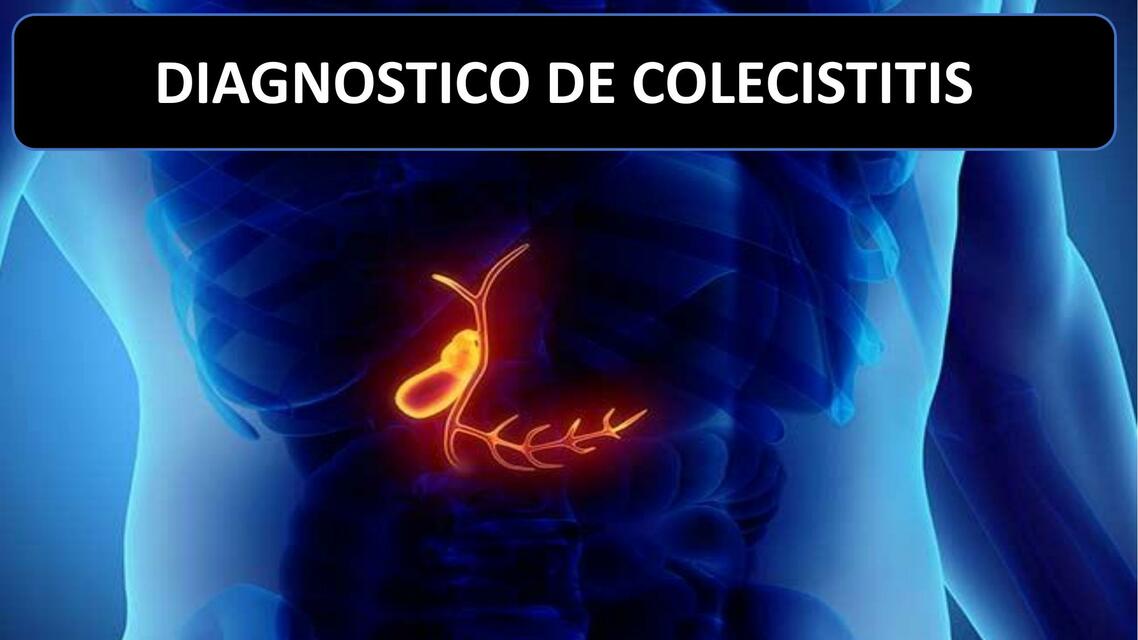 Diagnóstico de Colecistitis | Astrid Laupa | uDocz