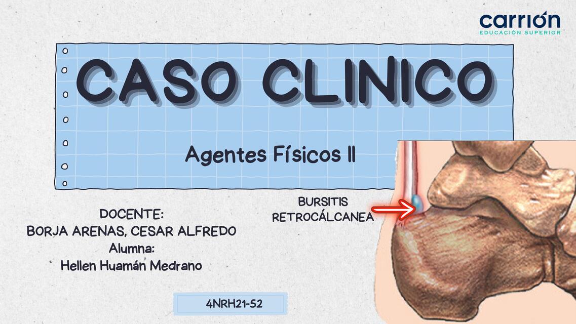 Bursitis retrocalcánea | Hellen Huamán Medano | uDocz