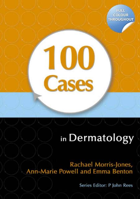 100 Cases in Dermatology | Estudiante enfermeria | uDocz
