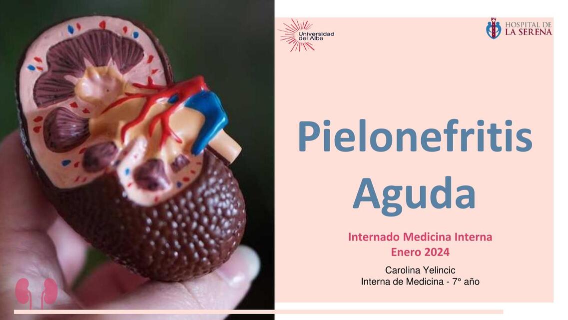 Flashcards de Pielonefritis Aguda | Por Carolina Yelincic | uDocz