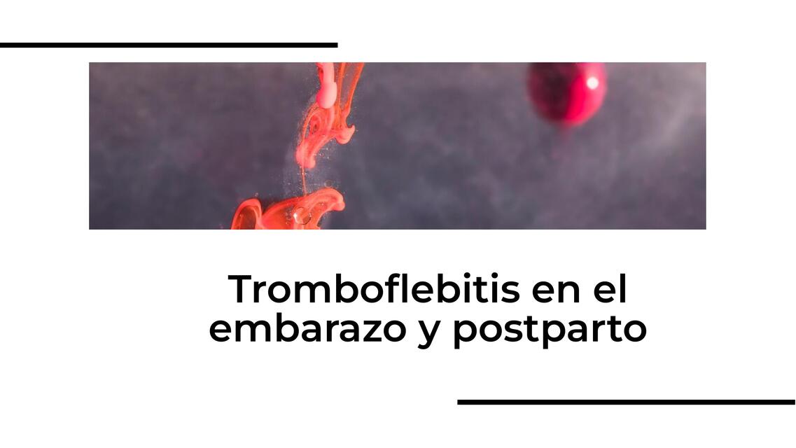 Tromboflebitis en el embarazo y postparto | bioanatomia | uDocz