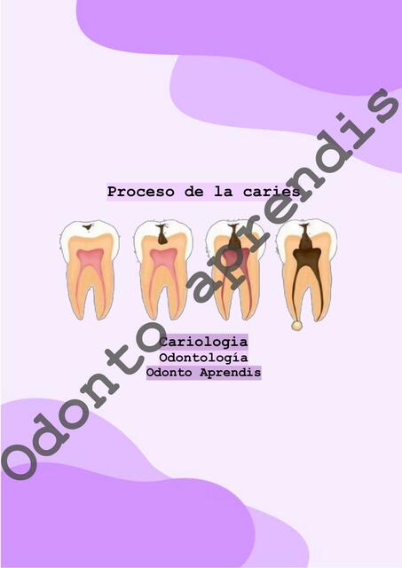 Proceso de la caries | Odonto Aprendis | uDocz