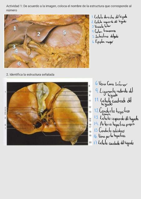 Práctica anatomía de hígado y vías biliares | Interleucina | uDocz