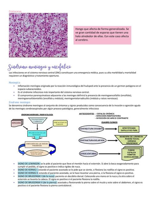Síndrome meningeo y encefálico | Montserrat Hernández | uDocz