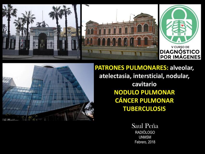 Patrón nodular y TBC | Un poco de cursos | uDocz