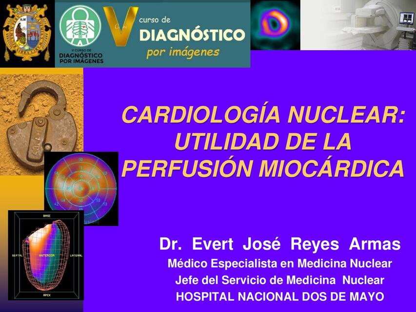Cardiología Nuclear Perfusión Miocárdica | Un poco de cursos | uDocz