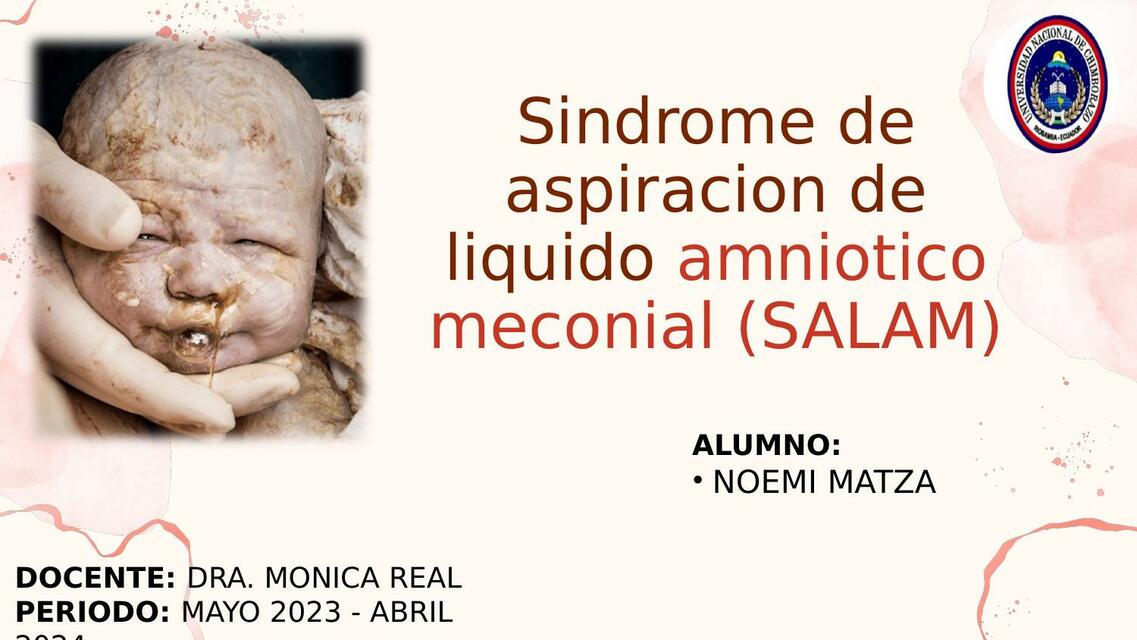 ASPIRACION MECONIAL | Noemi Matza | uDocz