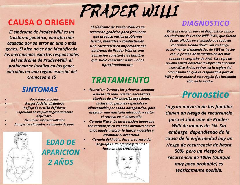 Síndrome de Prader-Willi | Tiare Muñoz | uDocz
