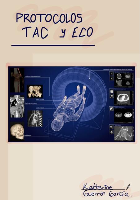 Protocolos de Tac | Katherine Guerron | uDocz