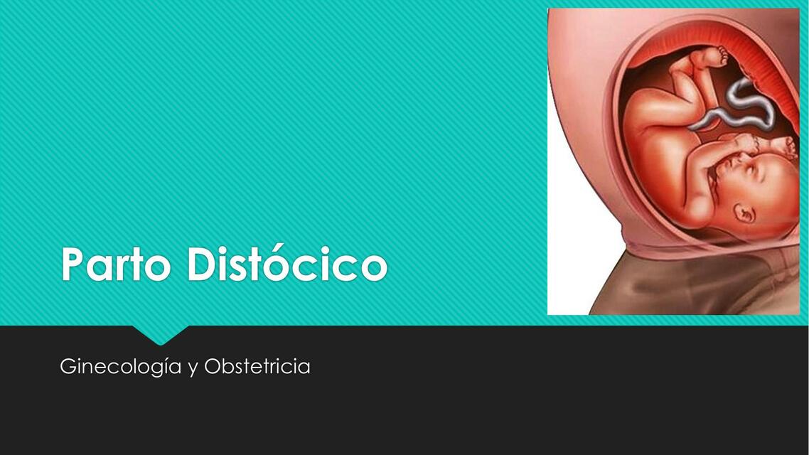 Parto Distócico | Alcides García. | uDocz