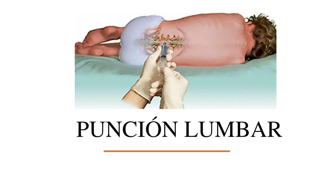Puncion lumbar | Ediluis | uDocz