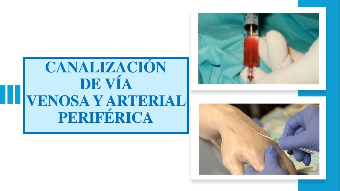 Canalizació de vía venosa y arterial periferica | Ediluis | uDocz