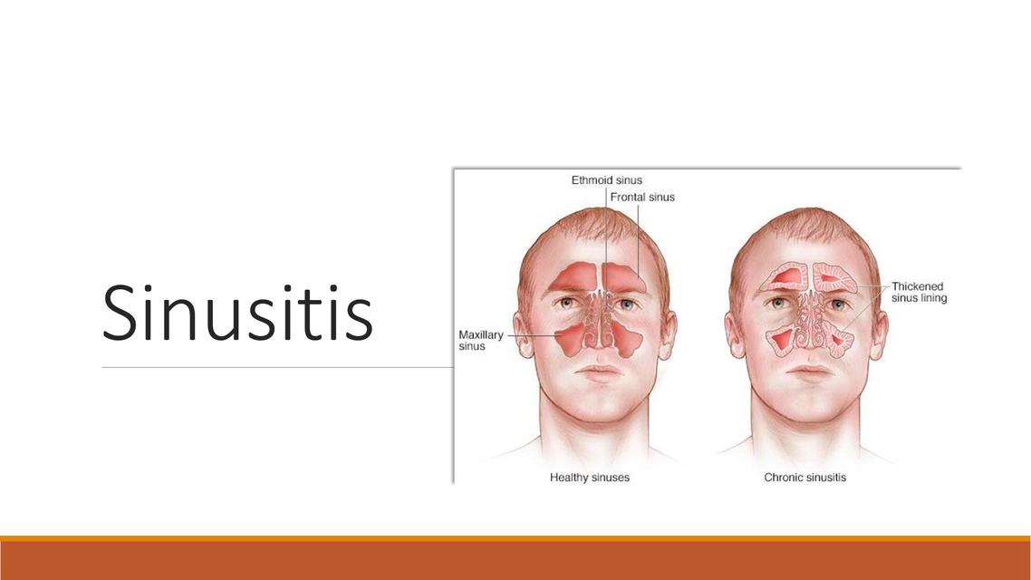Sinusitis 2 | Regina Morales | uDocz