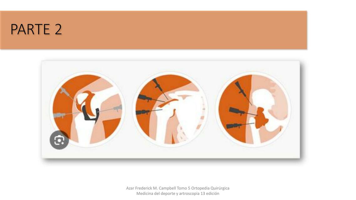 Generalidades artroscopia | Karla Quintero | uDocz