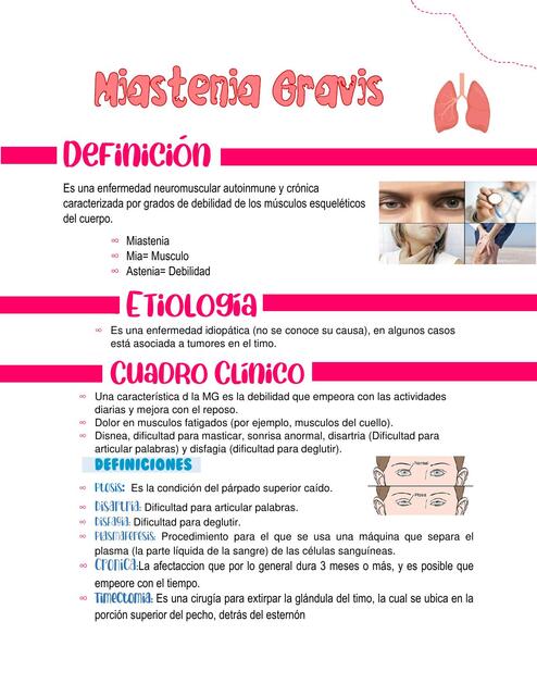 Miastenia gravis | Kris | uDocz