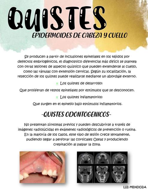 QUISTES | uDocz creators | uDocz