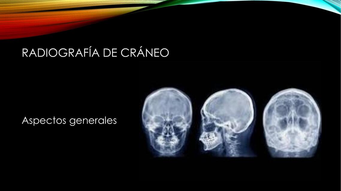 Resúmenes de Radiografía de cráneo | Descarga apuntes de Radiografía de ...