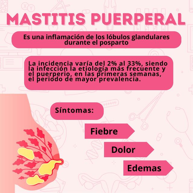 Mastitis Puerperal | Obstetricia.Con.Mabel/ | uDocz