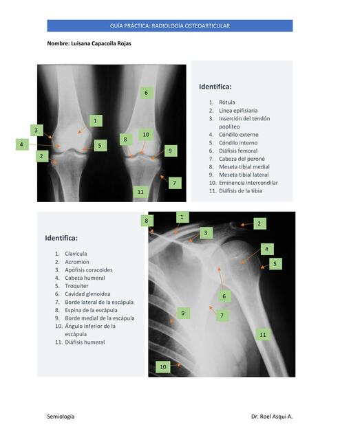 GUÍA SEMIOLOGÍA OSTEOARTICULAR | Luisana Aneth CR | uDocz