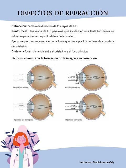 DEFECTOS DE REFRACCIÓN | Medicina con Ody | uDocz