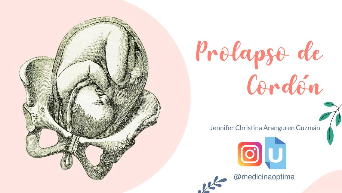 Prolapso de Cordón | Medicina Óptima | uDocz