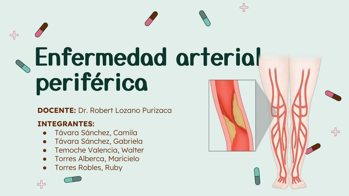 Enfermedad arterial periférica | Walter Temoche Valencia | uDocz