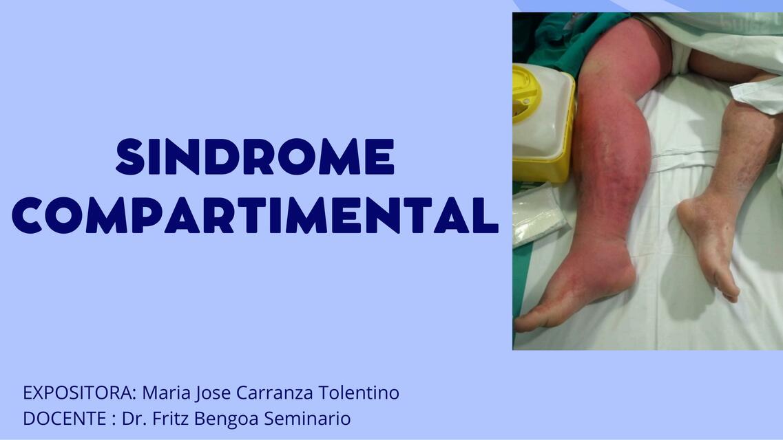 Síndrome compartimental | MARIA JOSE CARRANZA TOLENTINO | uDocz