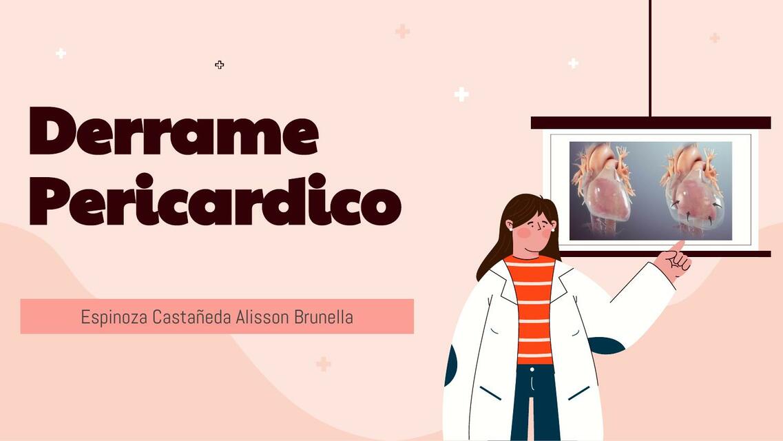 Derrame Pericárdico | Alisson1108 | uDocz