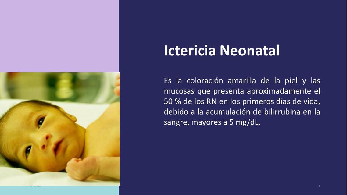 Ictericia Neonatal | Marina Paz | uDocz