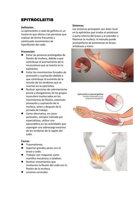 Epitrocleitis | Liza Stuudio | uDocz