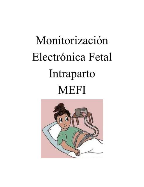 Monitorización Electrónica Fetal Intraparto MEFI | Nicole Rodriguez ...
