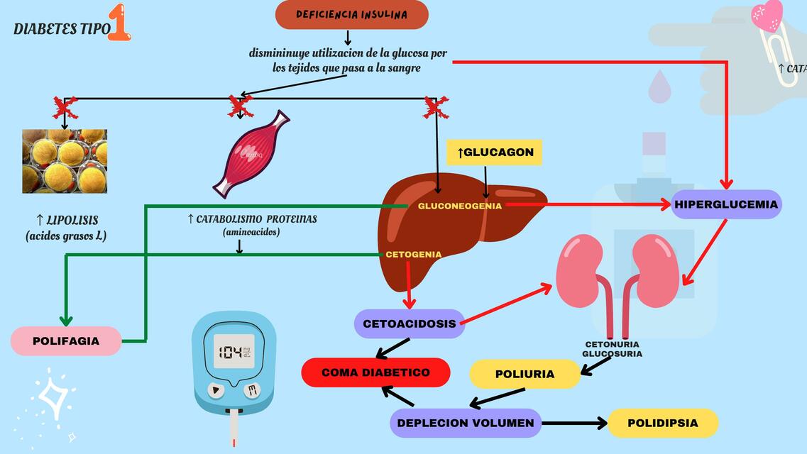 DIABETES TIPO 1 - FISIOPATOLOGIA | Denilson Zubiate | uDocz
