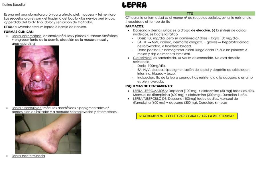 Lepra | Karine Bacellar | uDocz