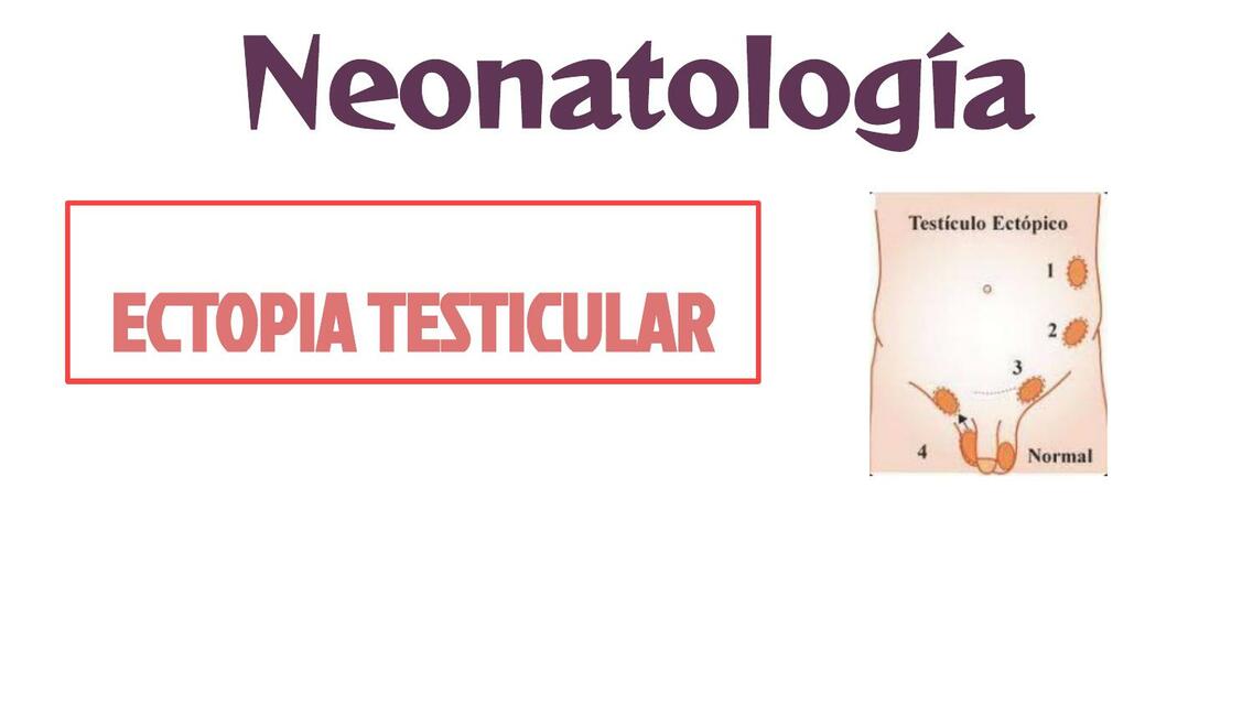 Ectopía testicular | Lupita | uDocz