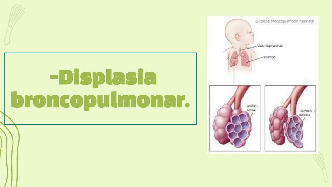 Displasia broncopulmonar | Lupita | uDocz