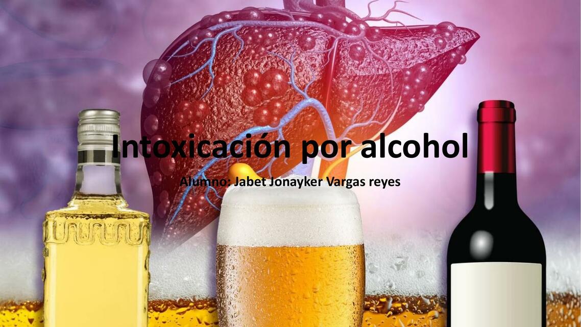 Intoxicación por alcohol | @CUIDADO.MEDICO | uDocz