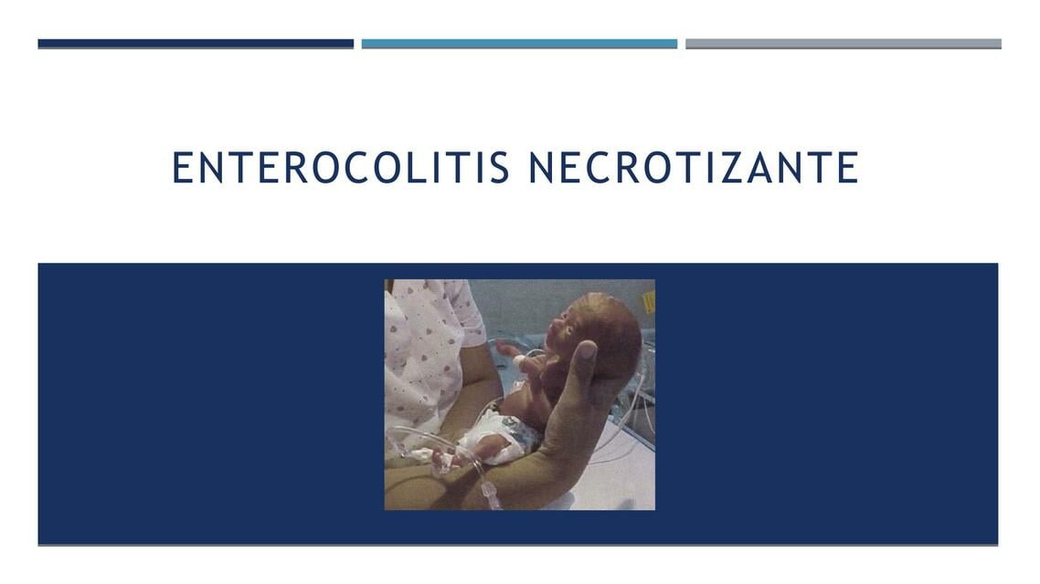 2.1. Enterocolitis Necrotizante | LiquidOH愛 | uDocz