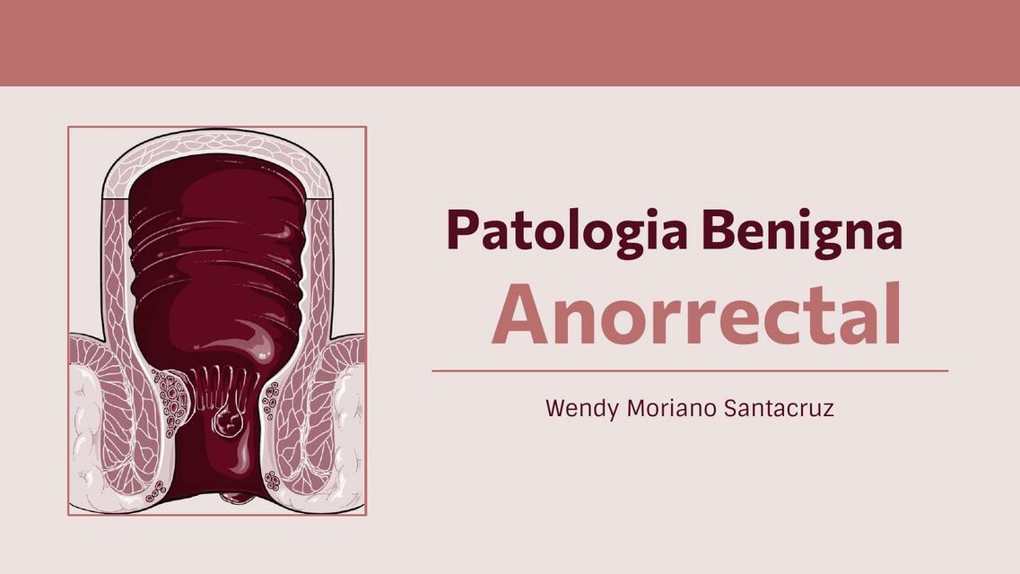 Patologia benigna Anorrectal | Wendy | uDocz
