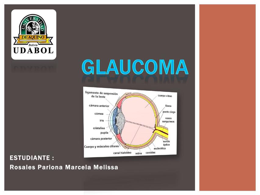 GLAUCOMA | MARCELA MELISSA ROSALES PARIONA | uDocz