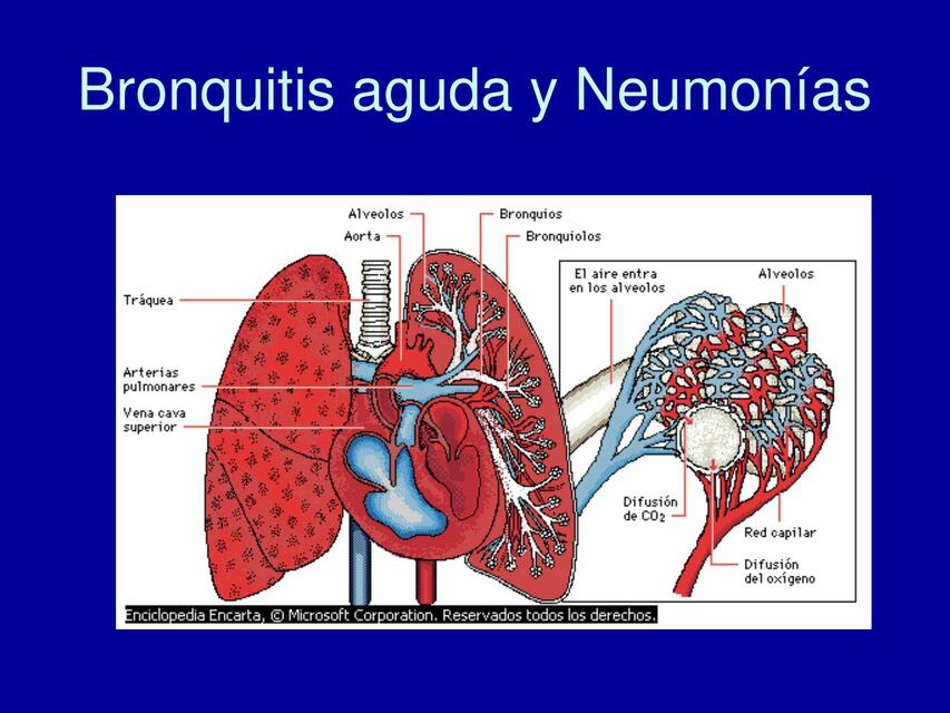 Flashcards de Bronquitis aguda y Neumonías | Por medi_fer | uDocz