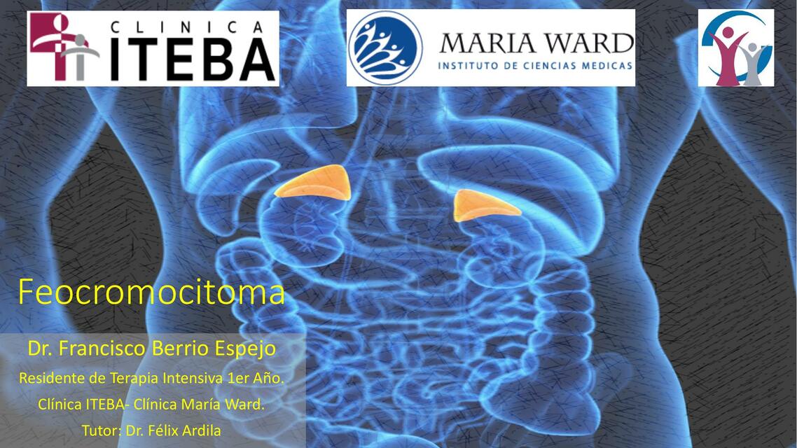 Feocromocitoma | Francisco Berrio | uDocz
